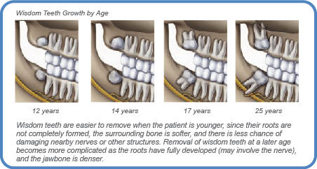 wisdom teeth removal recovery stages